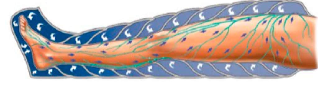 Lymphastim - Cellulite Treatment Vancouver | Arion Skin Laser